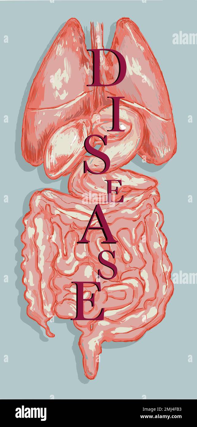 illness concept vector banner illustration Stock Vector Image & Art - Alamy