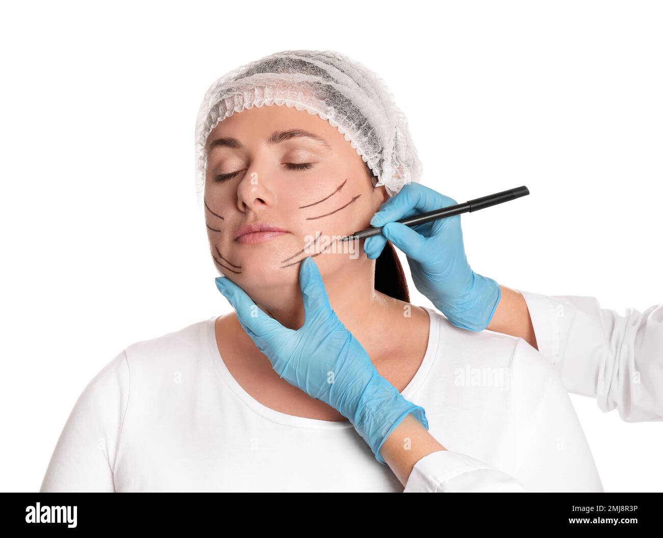 Doctor drawing marks on woman's face for cosmetic surgery operation ...