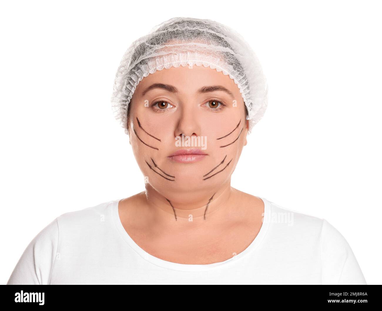 Woman with double chin ready for cosmetic surgery operation on white ...