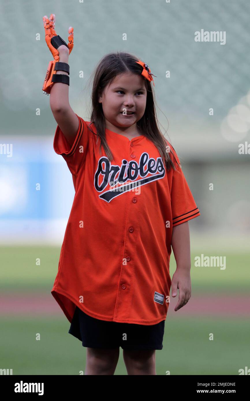 Hailey Dawson, who uses a special hand attachment because of a birth ...