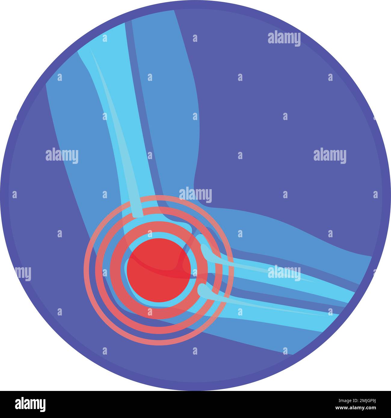 Elbow joint pain round icon. Medical illustration isolated on white ...