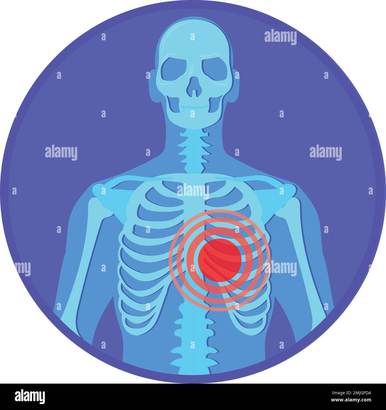 Chest pain icon. Round heart attack symbol isolated on white background ...