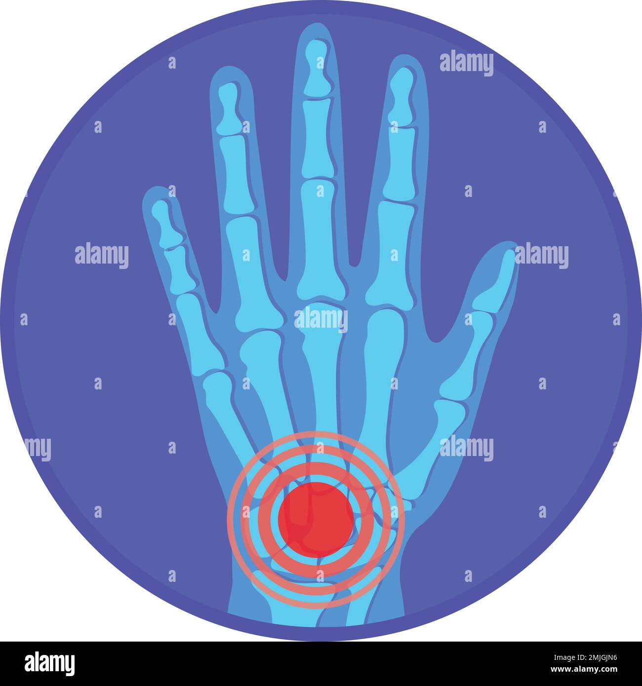 Wrist pain icon. Round hand ache symbol isolated on white background ...