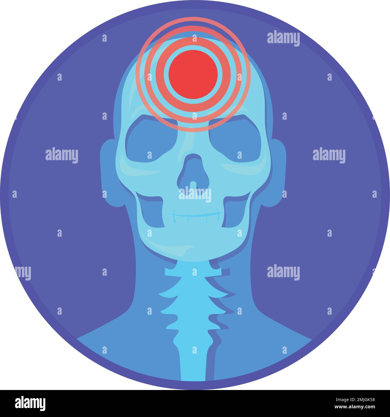 Headache round icon. Migraine symbol. Head pain isolated on white ...