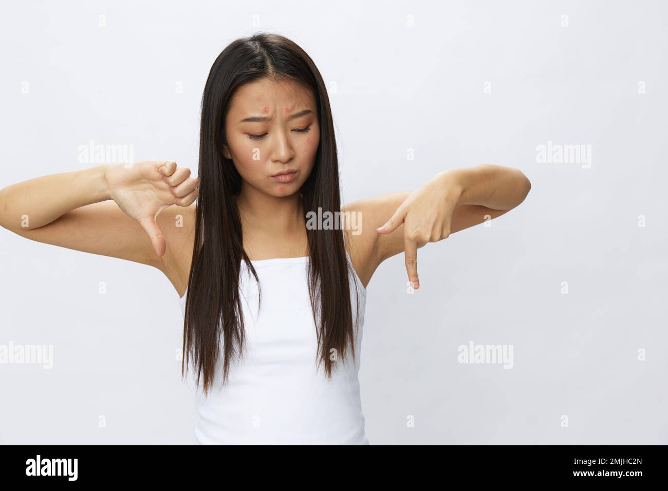 Asian woman facial skin problems, acne and inflammation, red rashes and ...