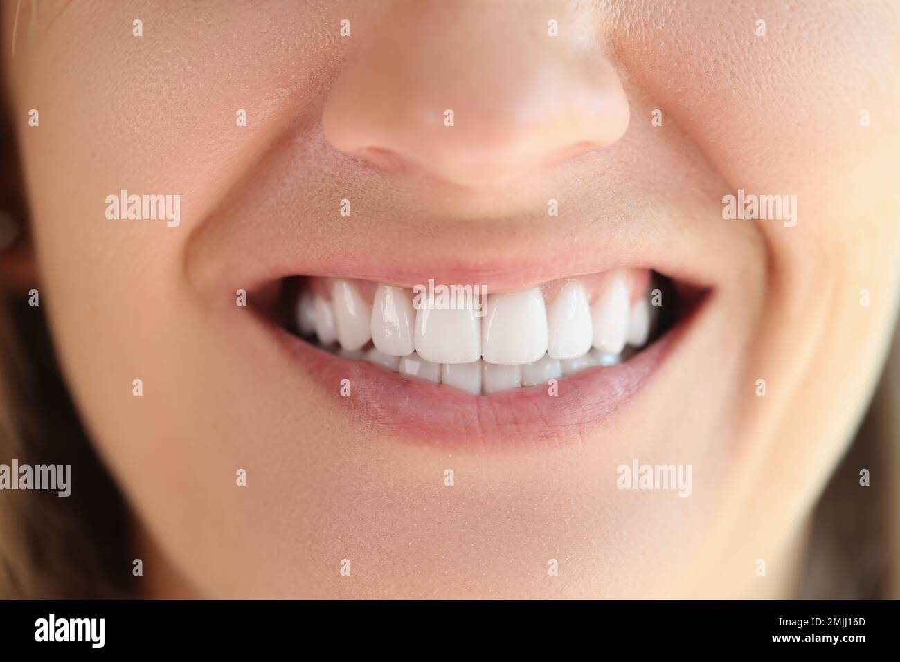 Close-up of female showing healthy smooth white teeth Stock Photo - Alamy