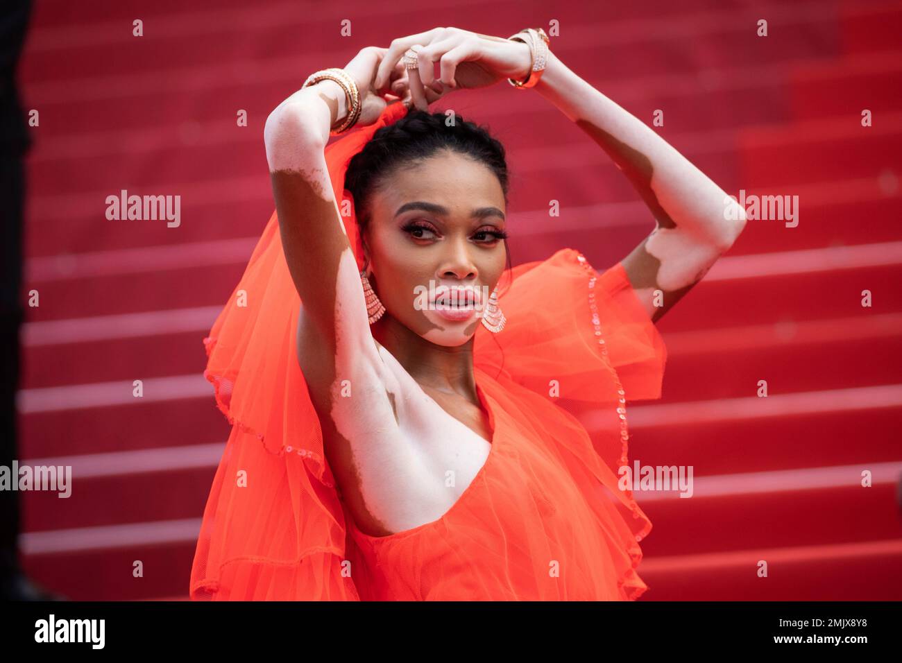 EDS NOTE: NUDITY - Model Winnie Harlow poses for photographers upon ...