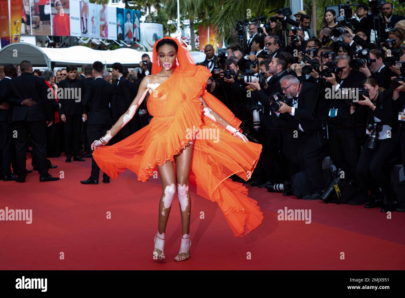 EDS NOTE: NUDITY - Model Winnie Harlow poses for photographers upon ...