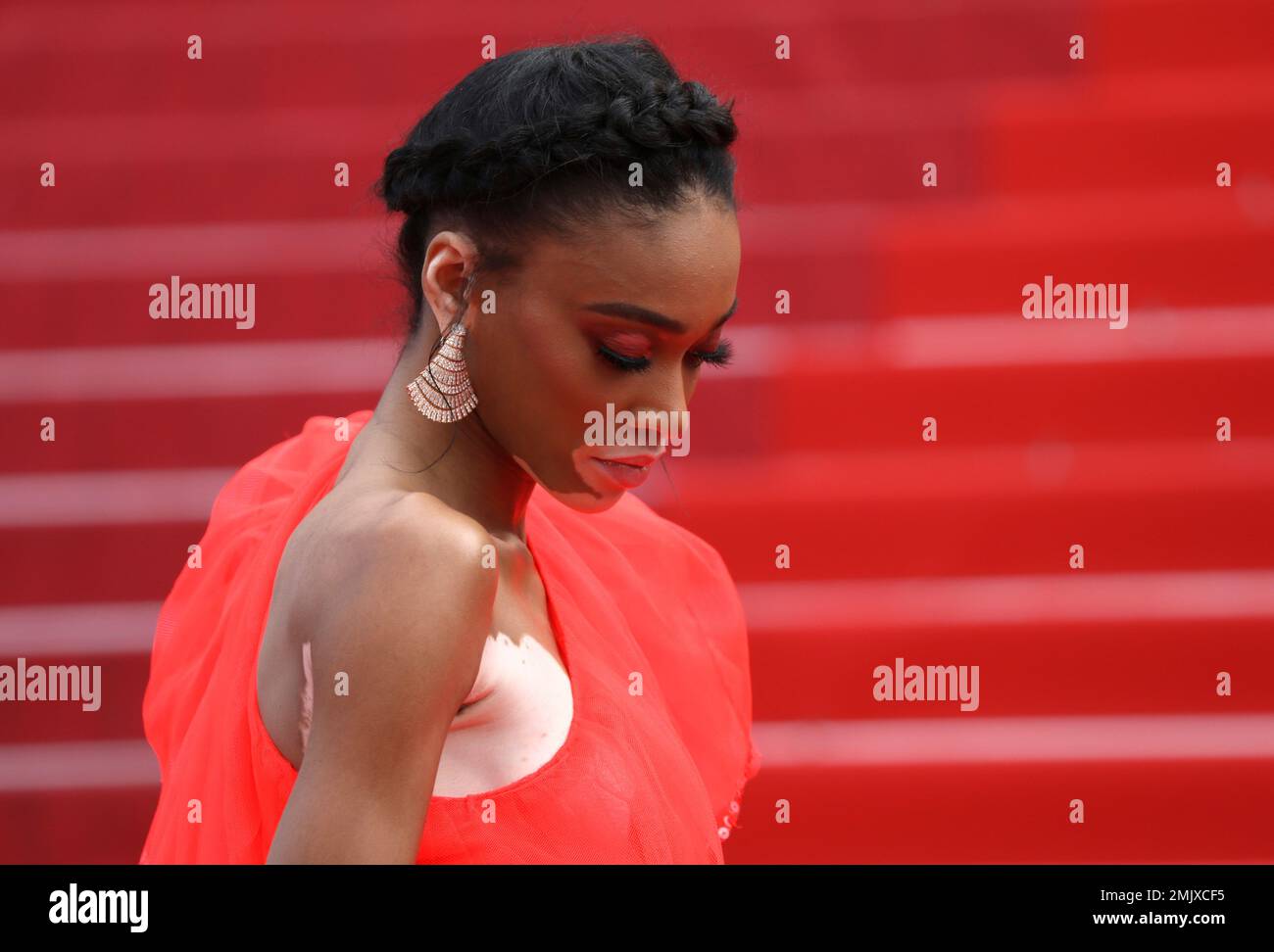 EDS NOTE: NUDITY - Model Winnie Harlow poses for photographers upon ...