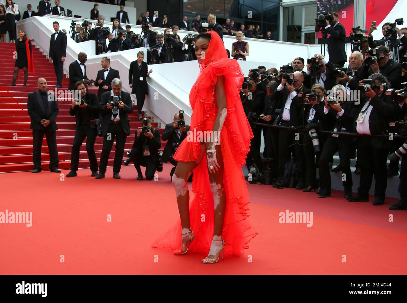 EDS NOTE: NUDITY - Model Winnie Harlow poses for photographers upon ...