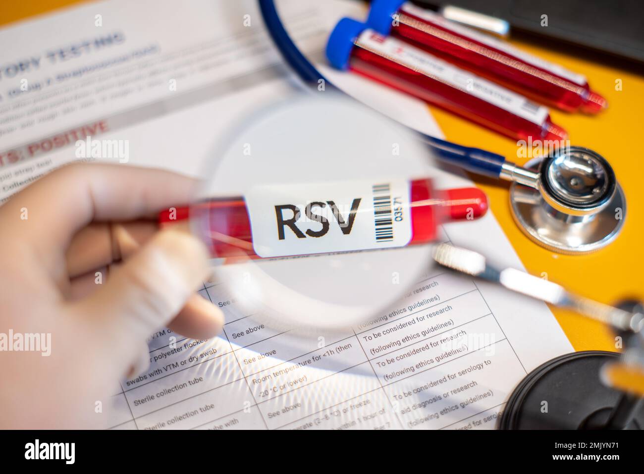 Blood collection tubes Respiratory syncytial virus(RSV) test positive ...