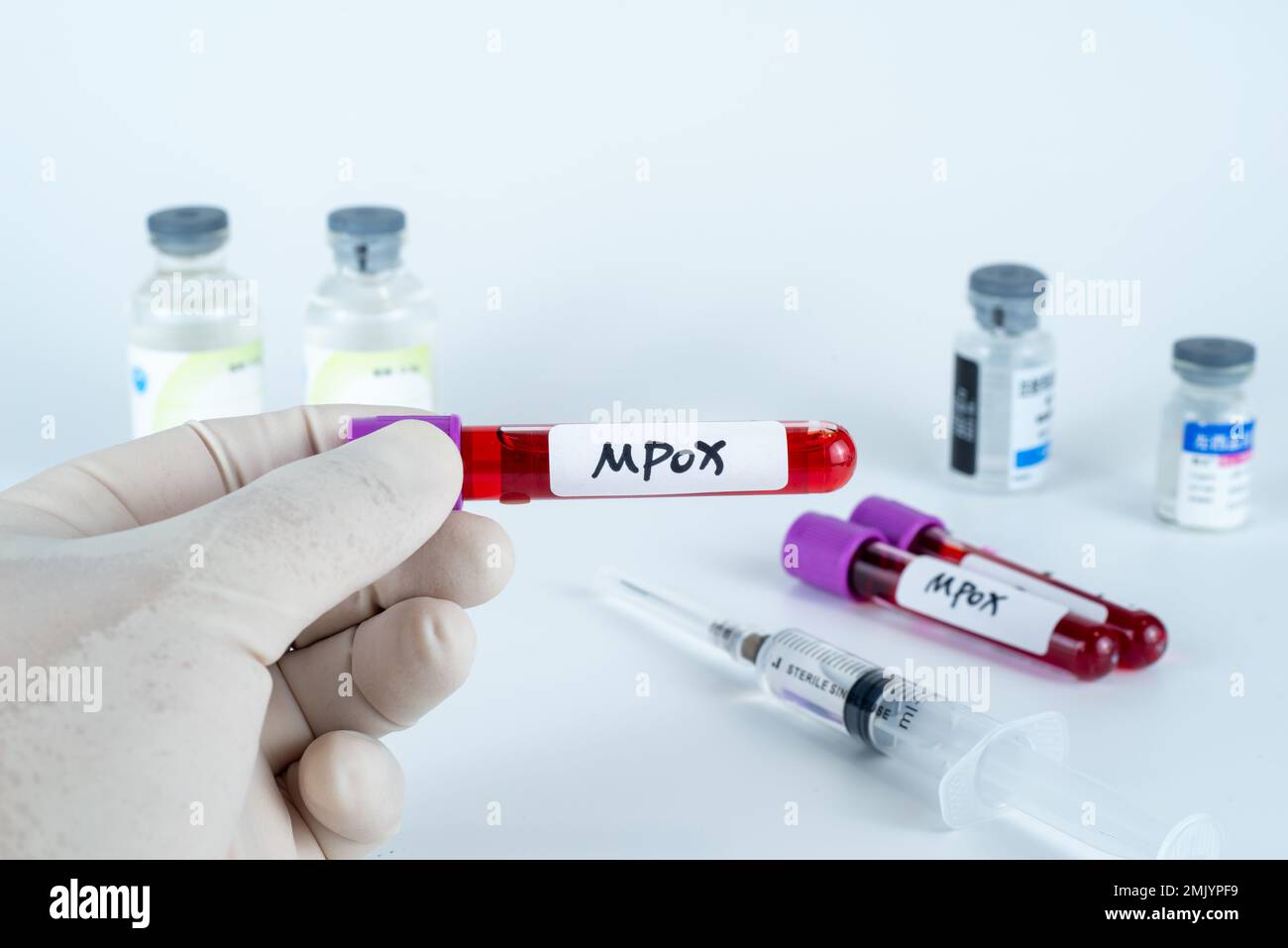 Blood collection tubes monkeypox （MPOX） test positive results Stock ...