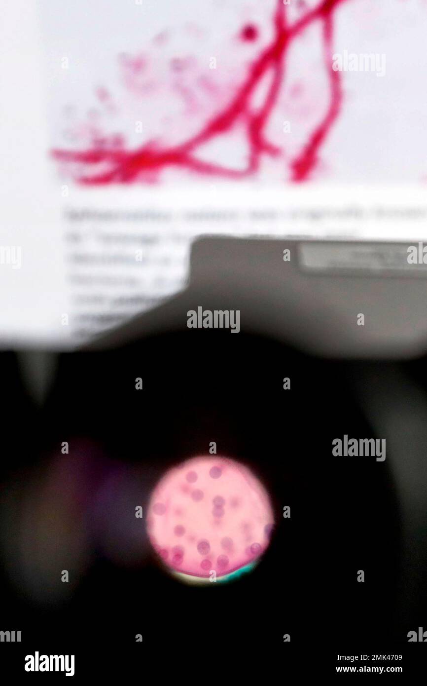 Sphaerotilus natans, an organism commonly known as "sewage fungus" is ...