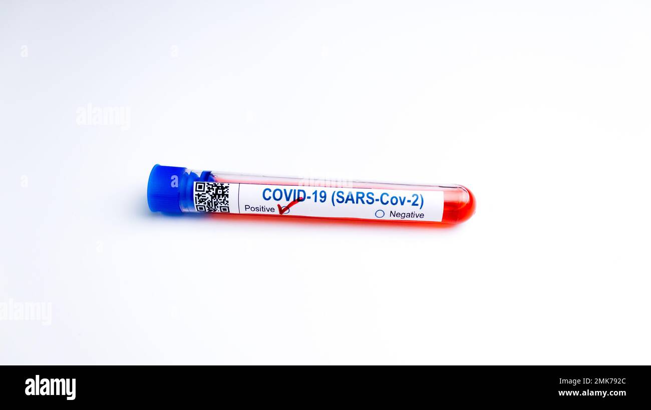 flasks with blood tests for monkey pox virus positive and negative ...