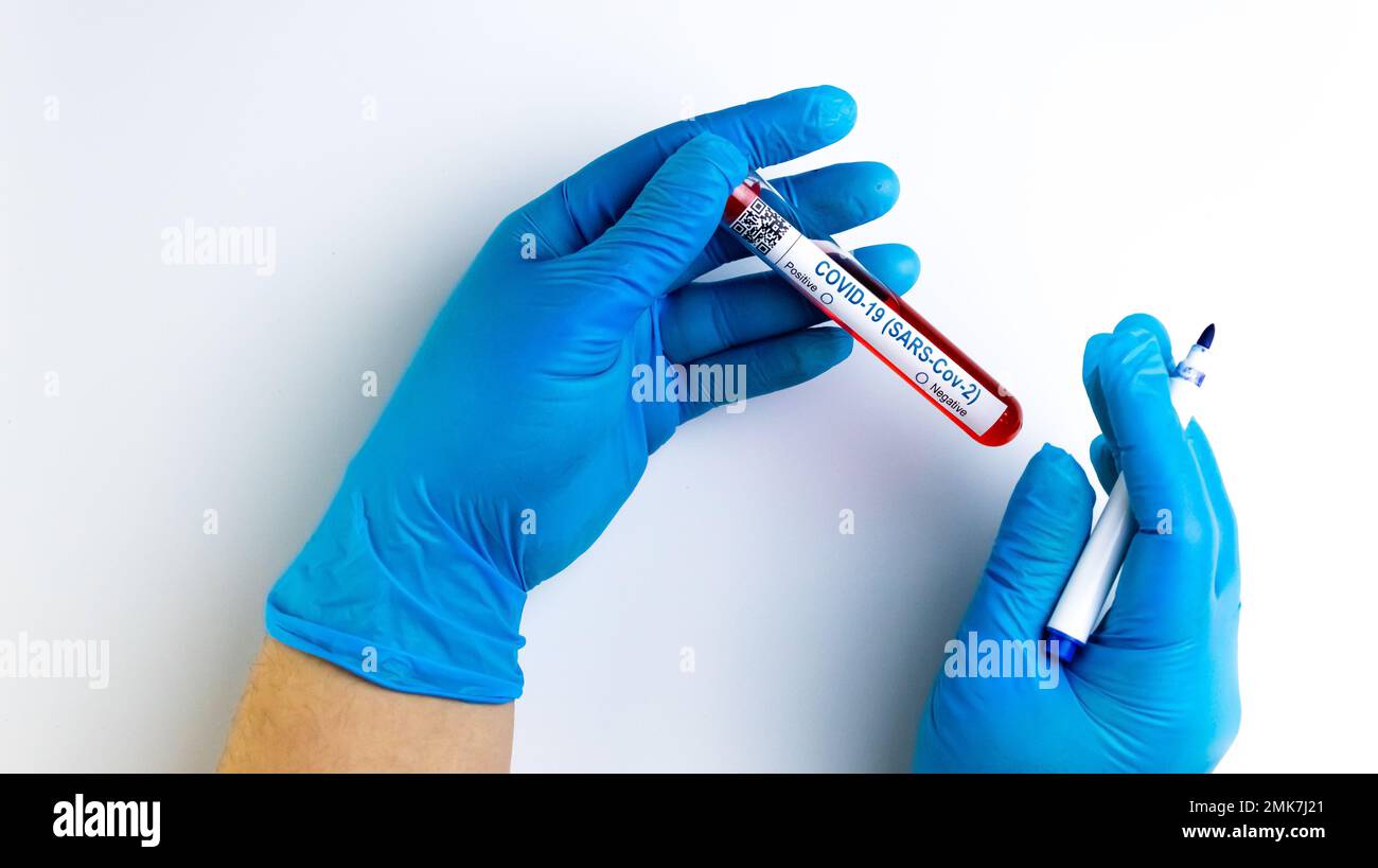 flasks with blood tests for monkey pox virus positive and negative ...