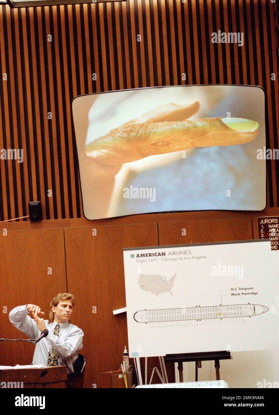 Dr. Robert Huizenga describes a cut on O.J. Simpson's left hand during ...