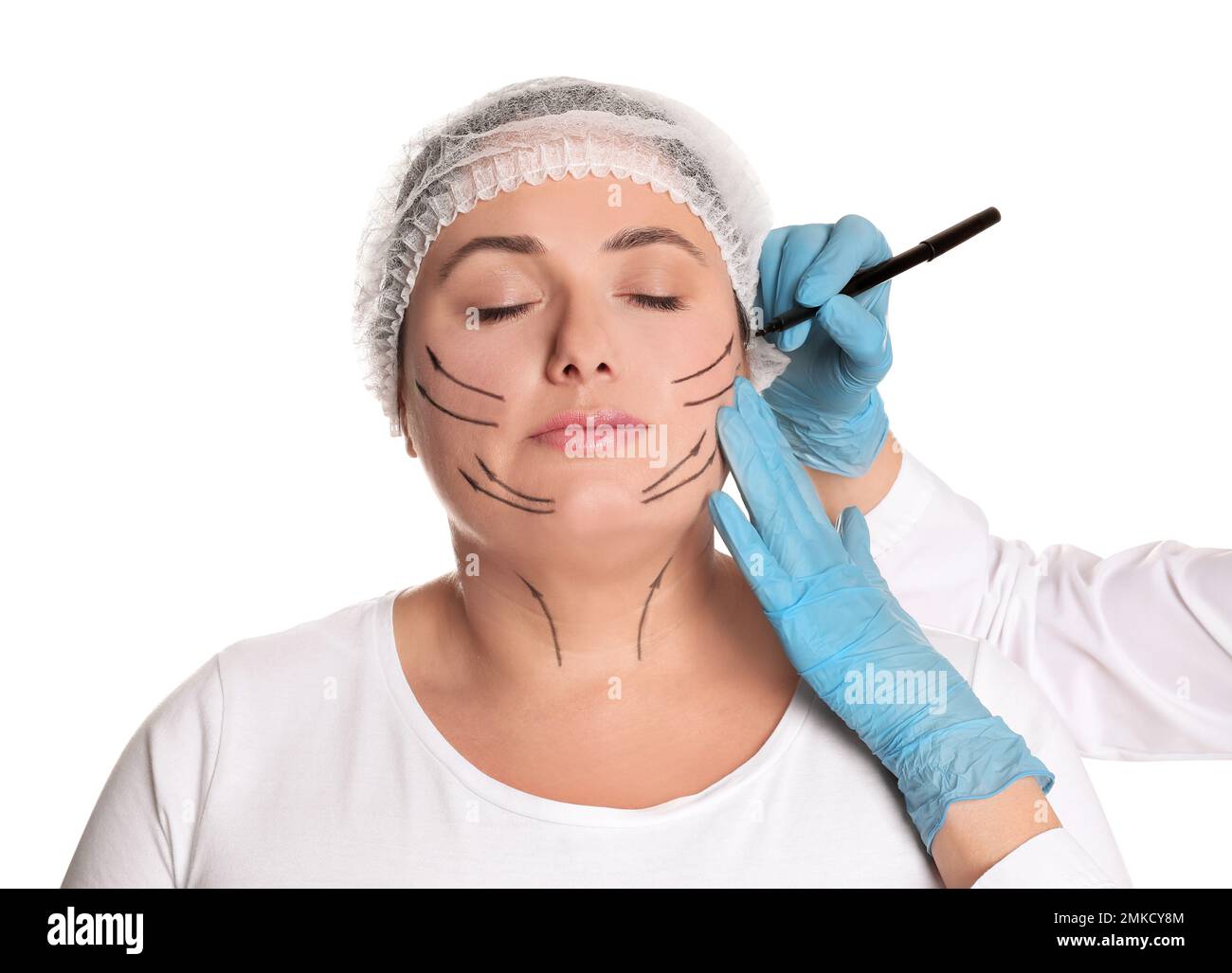 Doctor drawing marks on woman's face for cosmetic surgery operation ...