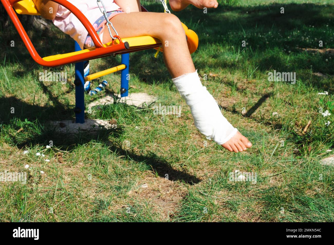 Children's legs are bandaged in plaster - barefoot on a swing ...