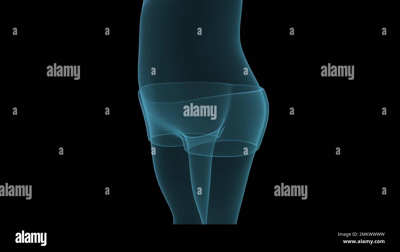Obesity process shown on x-ray 3d render Stock Photo - Alamy