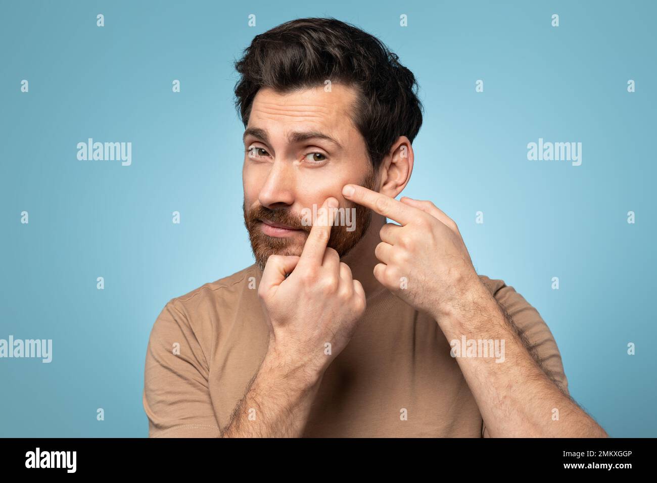 Portrait of bearded man touching his face, pressing pimple on face with ...