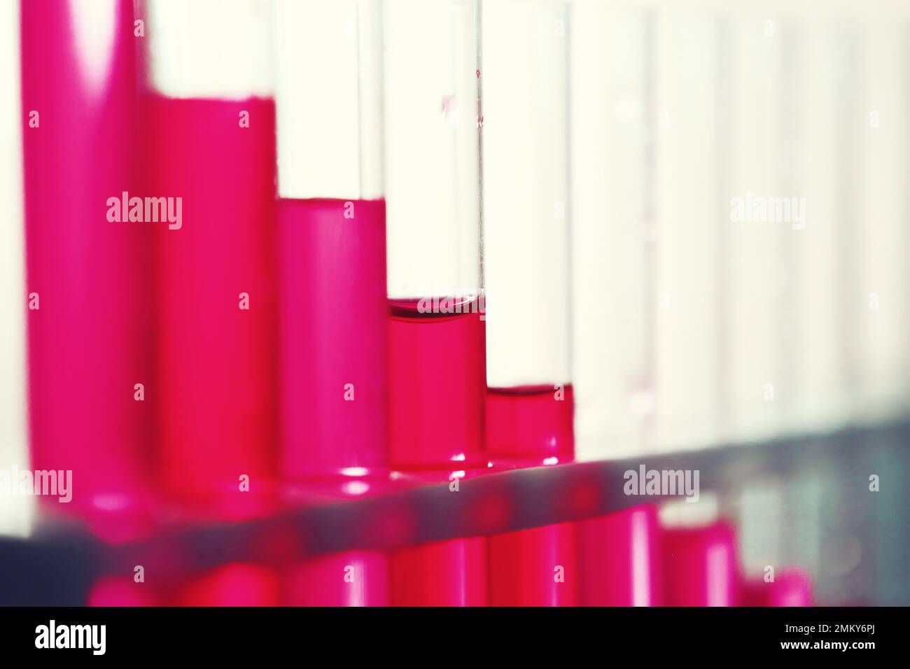 Test tube with blue liquid on laboratory table. Examination of liquid ...