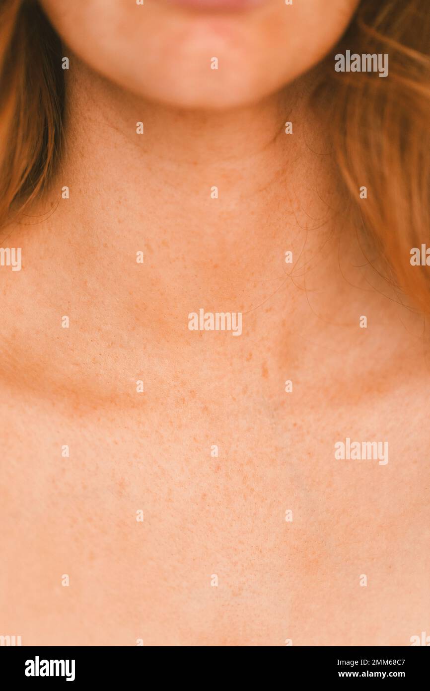 Clavicle Surface Piercing