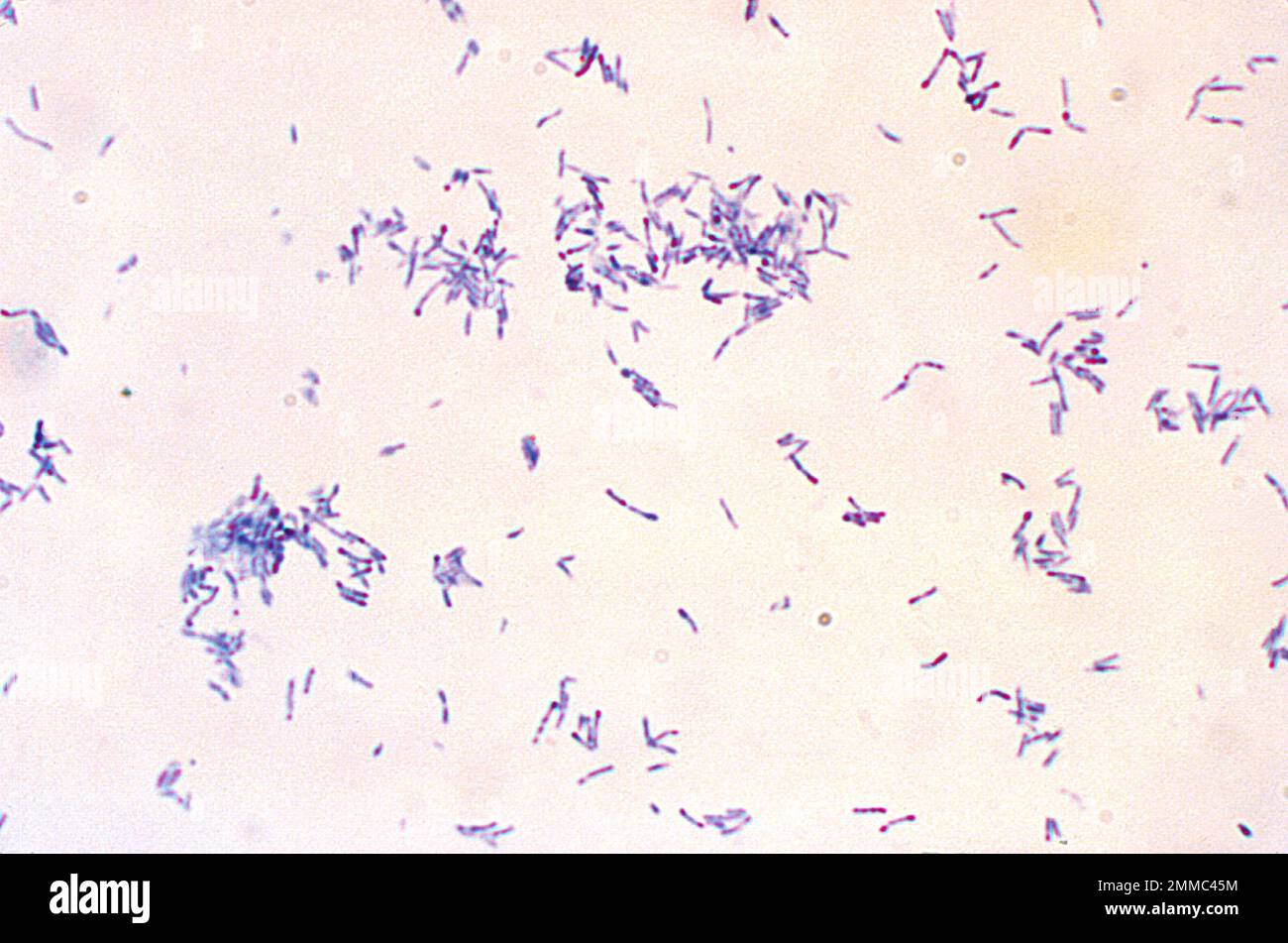 This undated microscope photo made available by the Centers for Disease ...