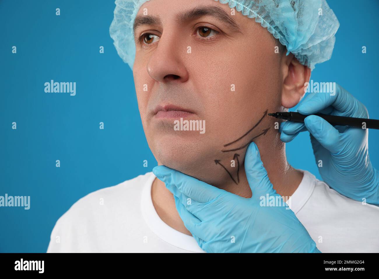Surgeon with marker preparing man for operation on blue background ...