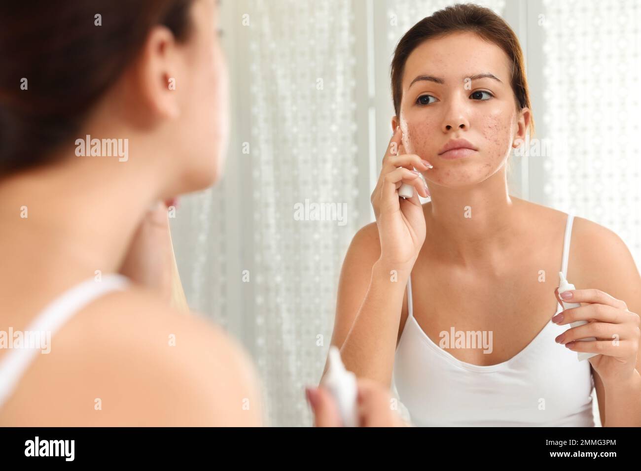 Teen girl problem skin in hi-res stock photography and images - Alamy