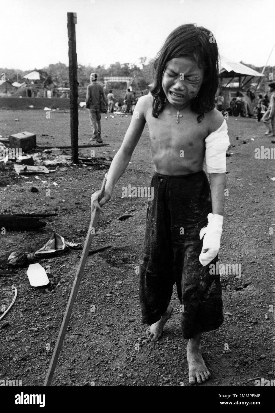 This little girl was injured and orphaned in a bloody battle in the ...