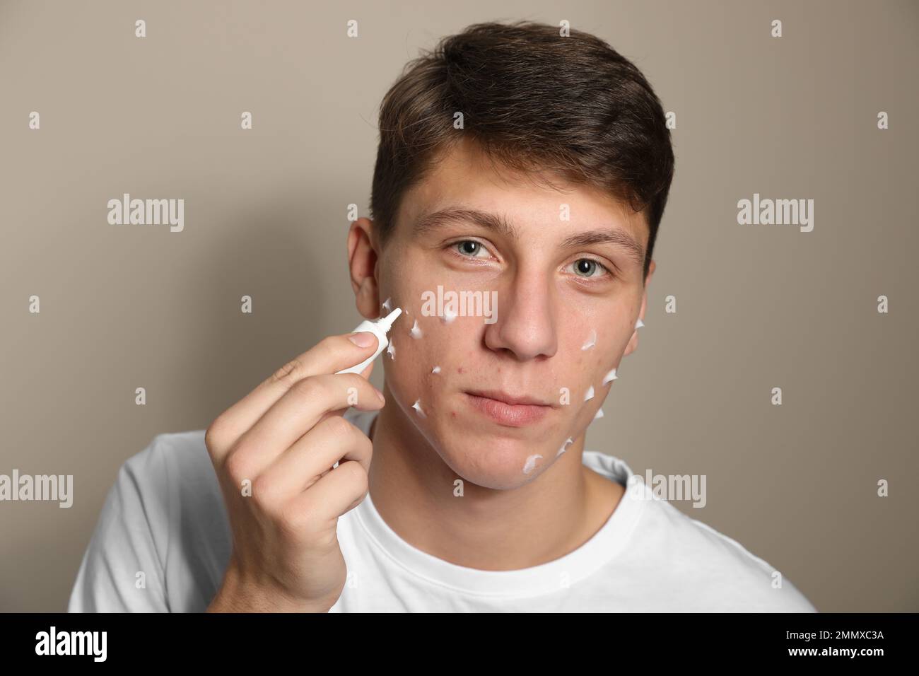 Teen guy with acne problem applying cream on beige background Stock ...