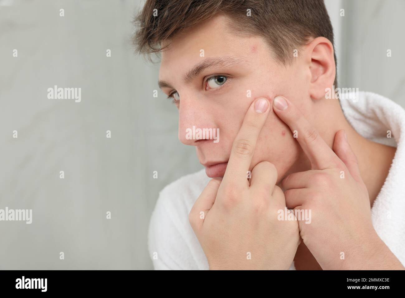 Teen guy with acne problem squeezing pimple in bathroom, closeup Stock ...