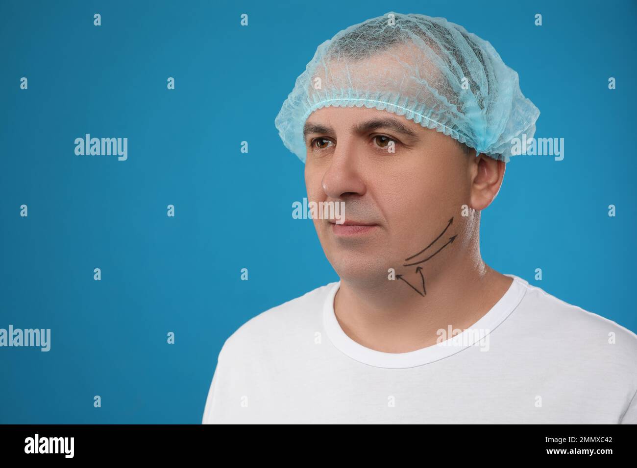 Mature man with marks on face against blue background. Double chin ...