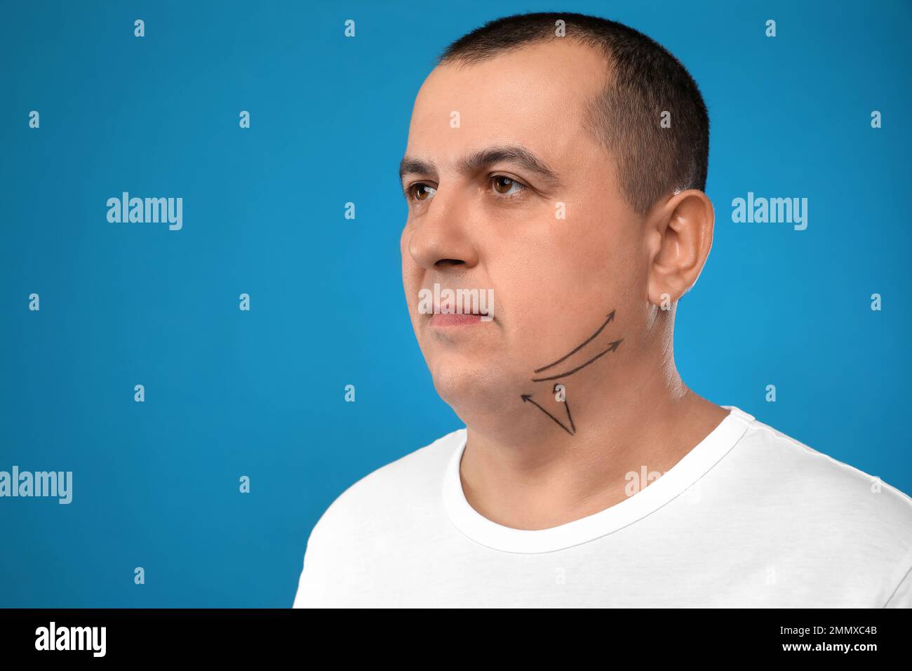 Mature man with marks on face against blue background. Double chin ...