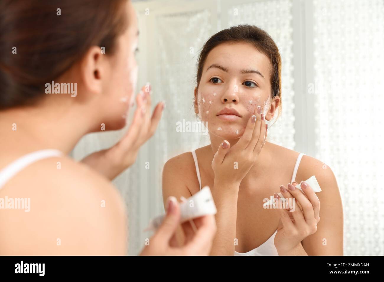 Teen girl problem skin in hi-res stock photography and images - Alamy