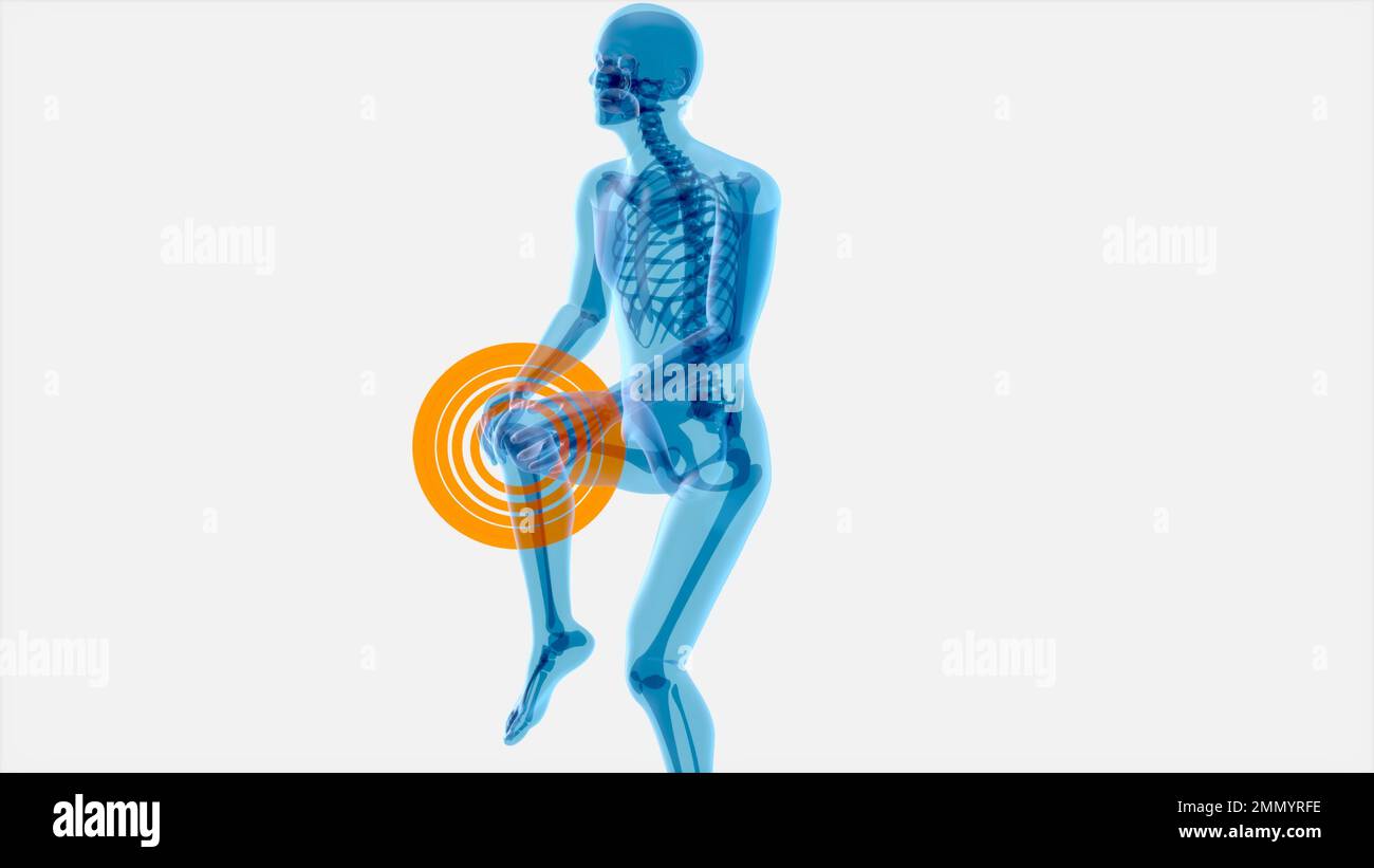 Abstract art of knee pain Stock Photo - Alamy