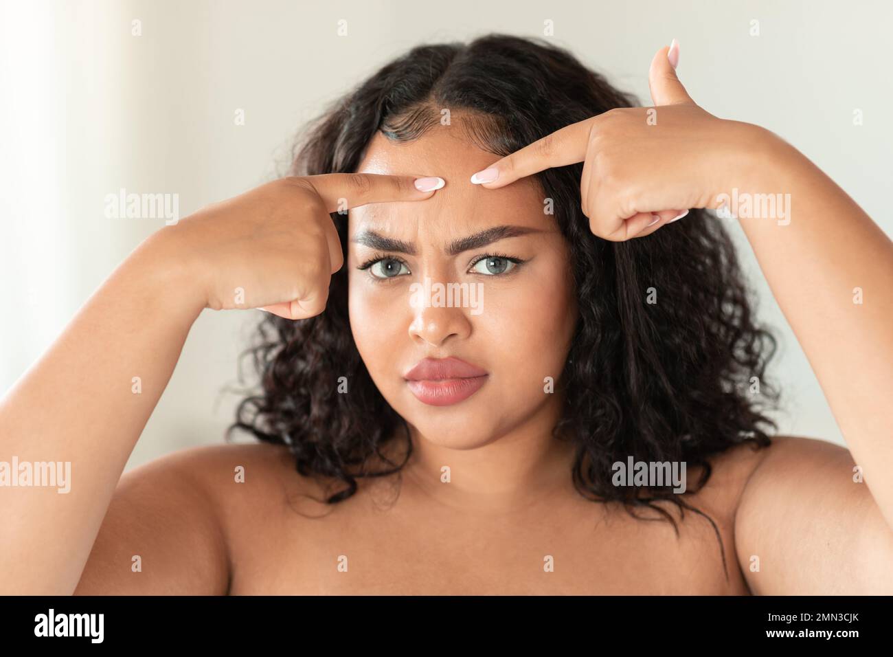 Irritated plus size woman suffering from acne, lady checking her face ...