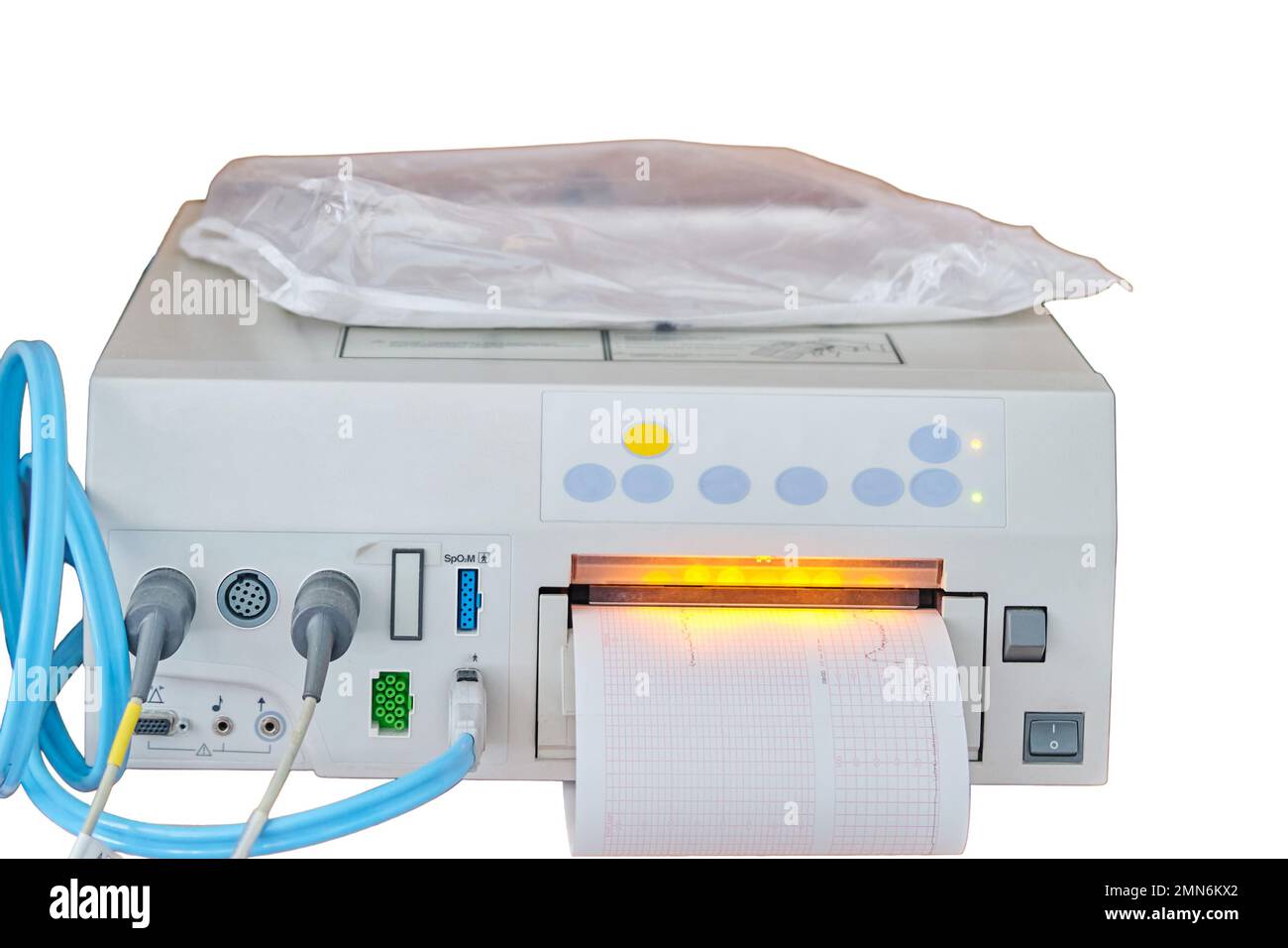 CTG device with monitoring of the state of health of the mother and ...