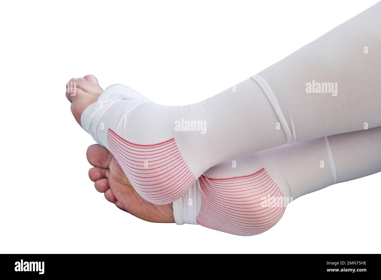 Legs of a pregnant woman in compression stockings on the bed at the ...