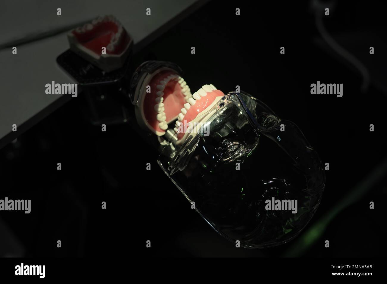 Plaster cast of the jaw in the articulator in the prosthetic workshop ...