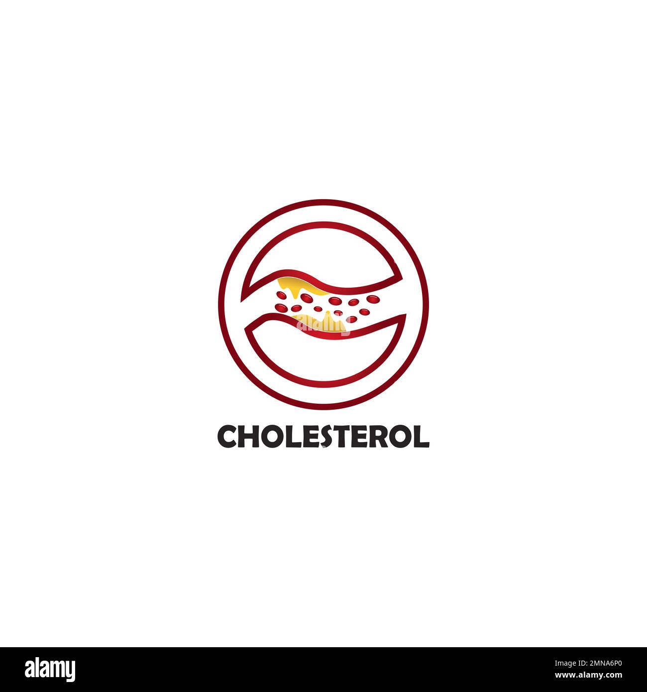 vector of cholesterol plaque illustratrion design Stock Photo - Alamy