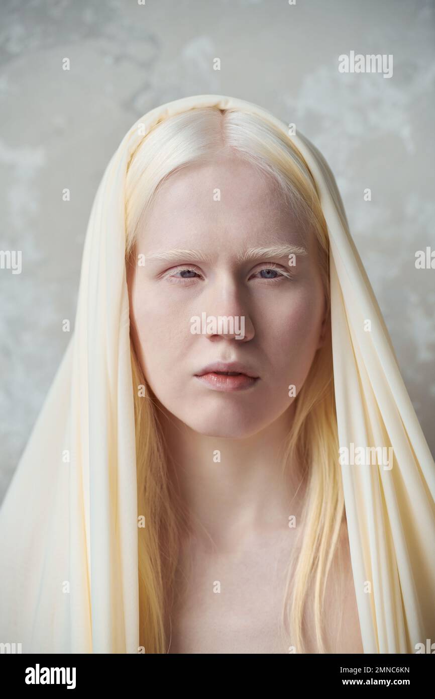 Albino Model Shaun Ross Nose