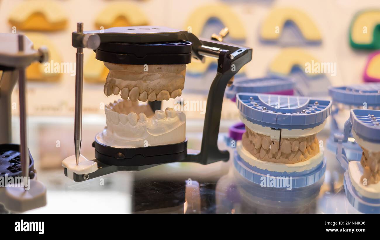 Plaster cast of the jaw in the articulator in the prosthetic workshop ...