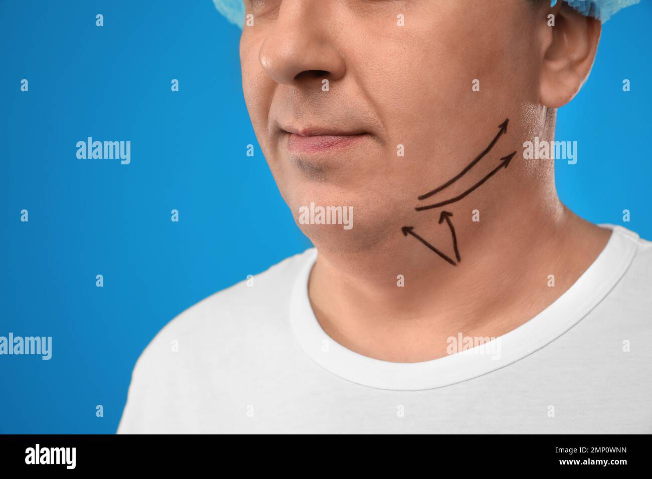 Mature man with marks on face against blue background, closeup. Double ...