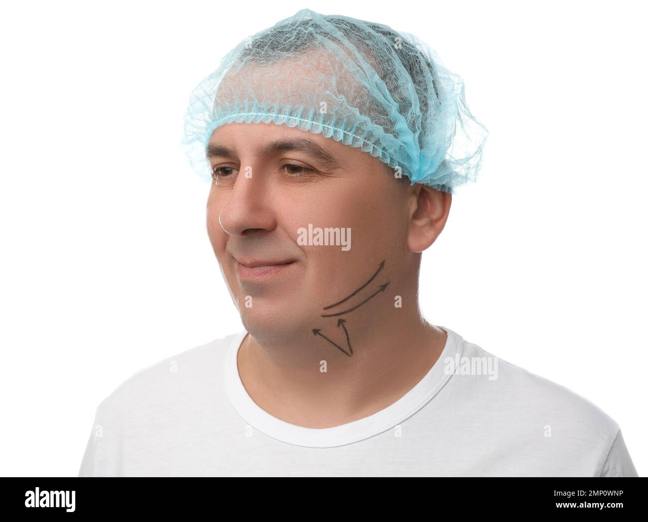 Mature man with marks on face against white background. Double chin ...