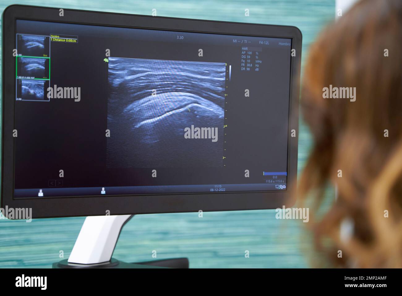 Ultrasound monitor hi-res stock photography and images - Alamy