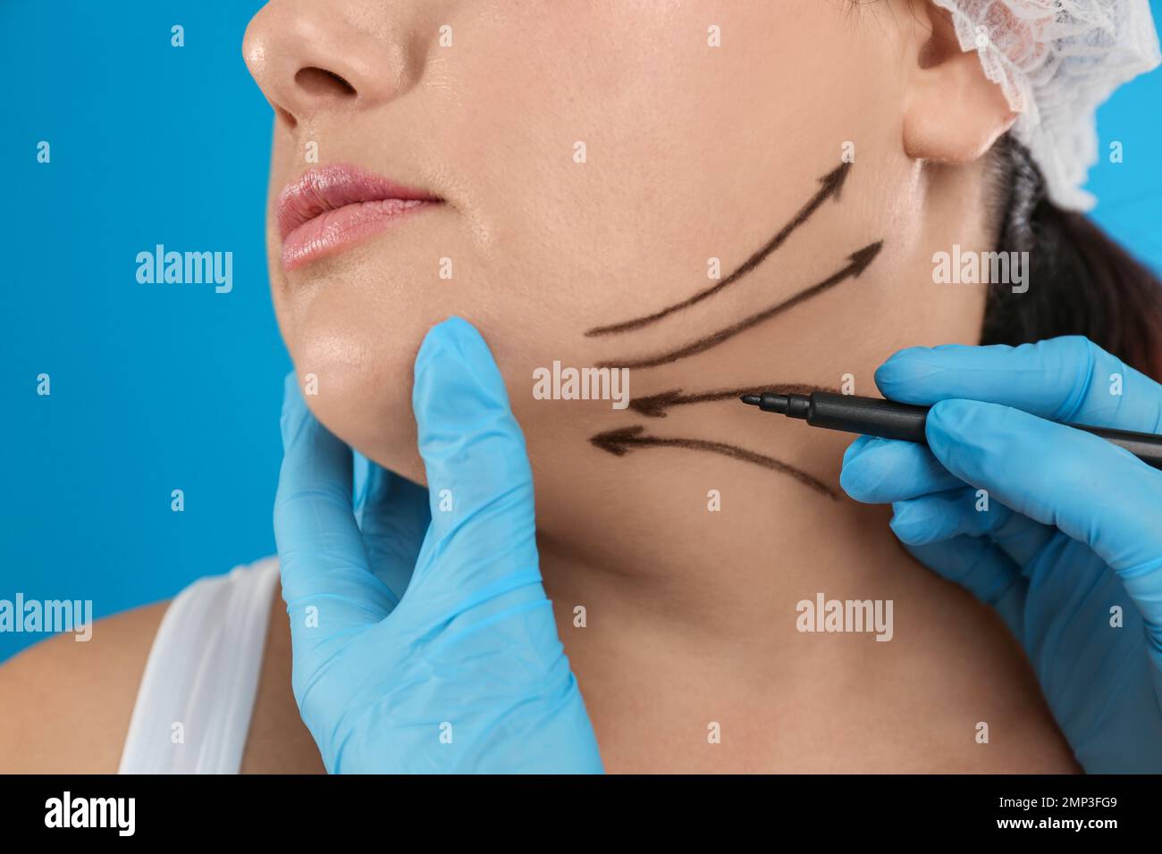 Doctor drawing marks on woman's face for cosmetic surgery operation ...