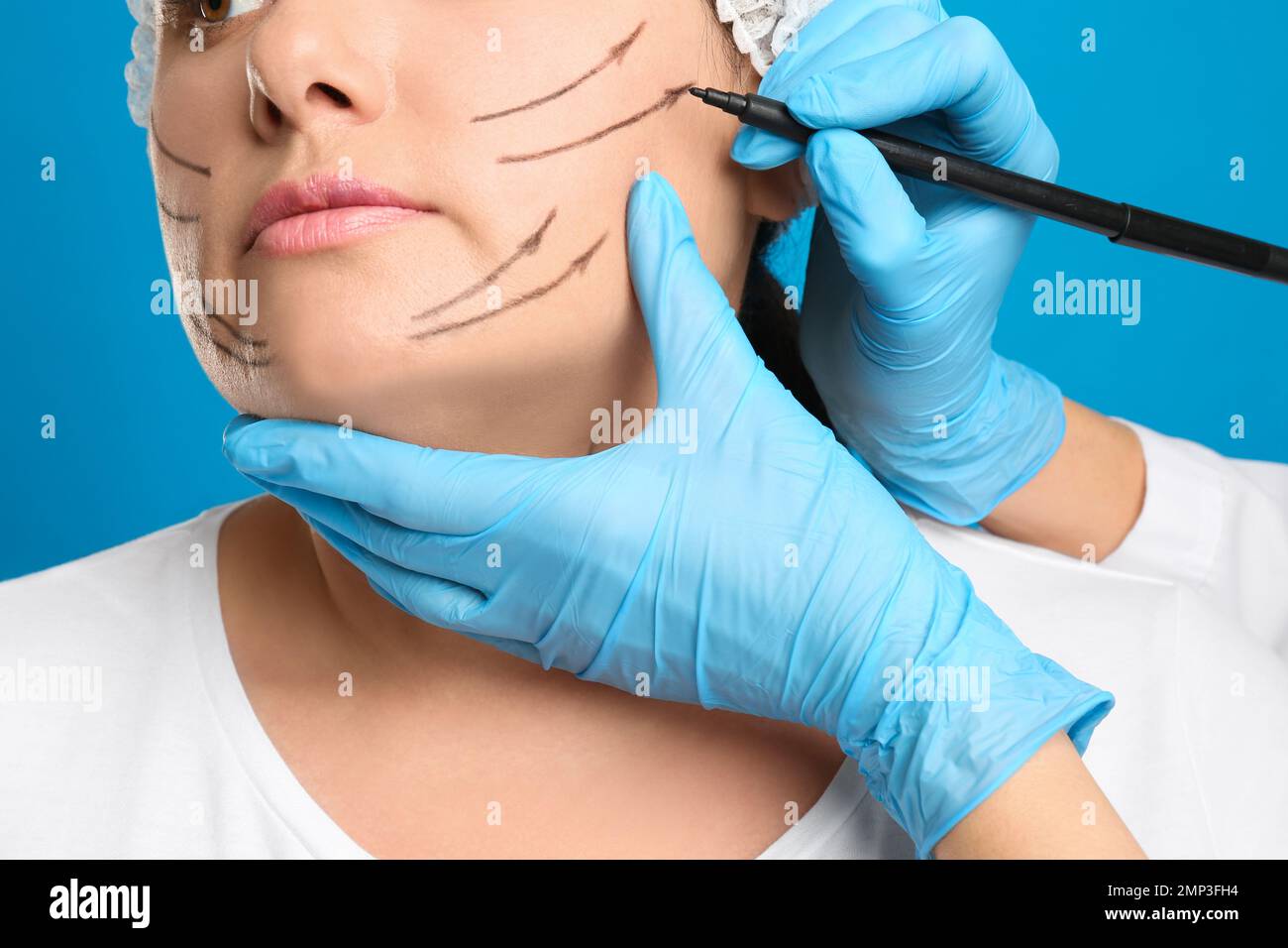 Doctor drawing marks on woman's face for cosmetic surgery operation ...