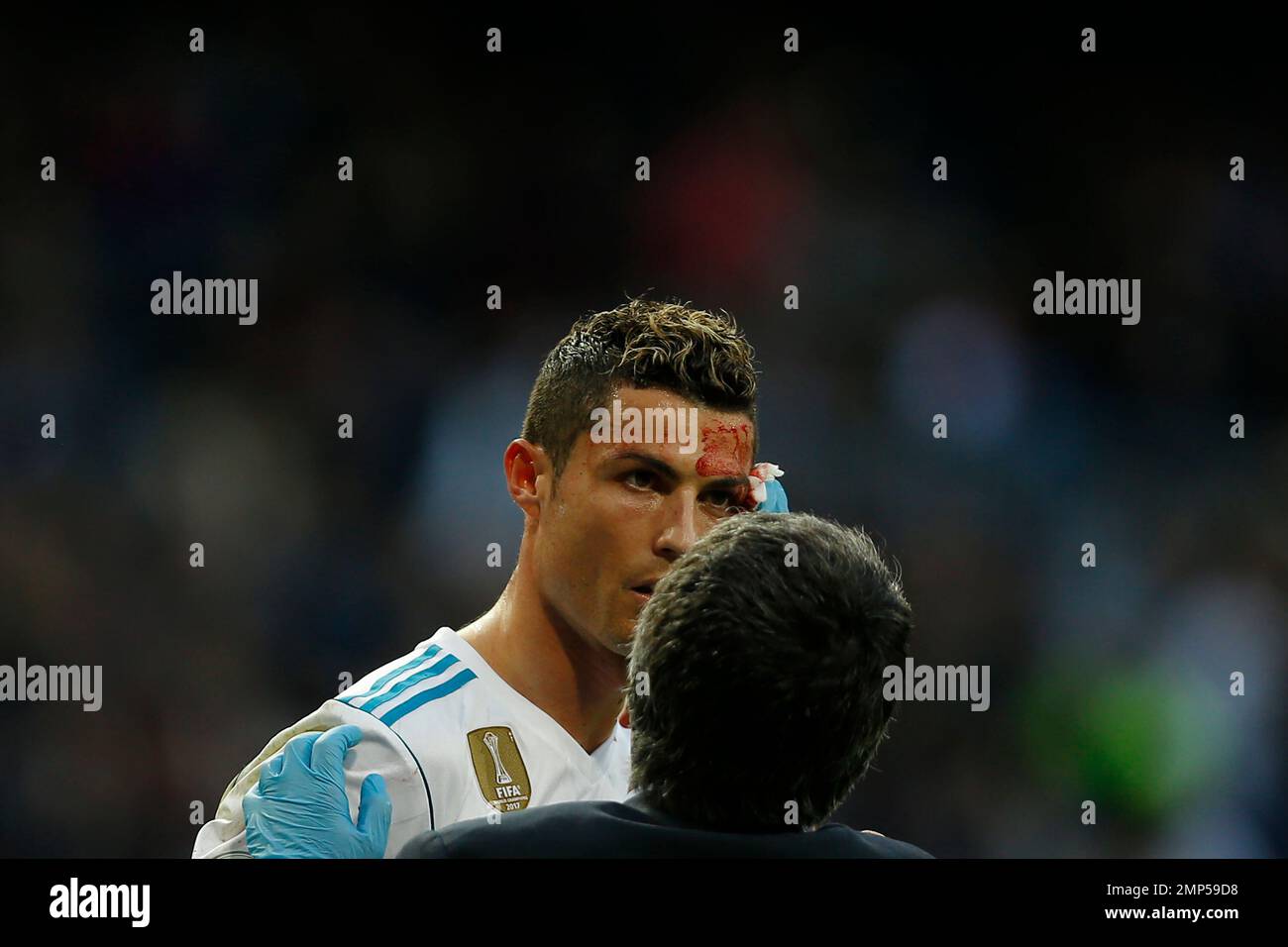 Real Madrid's Cristiano Ronaldo bleeds from his forehead during a ...