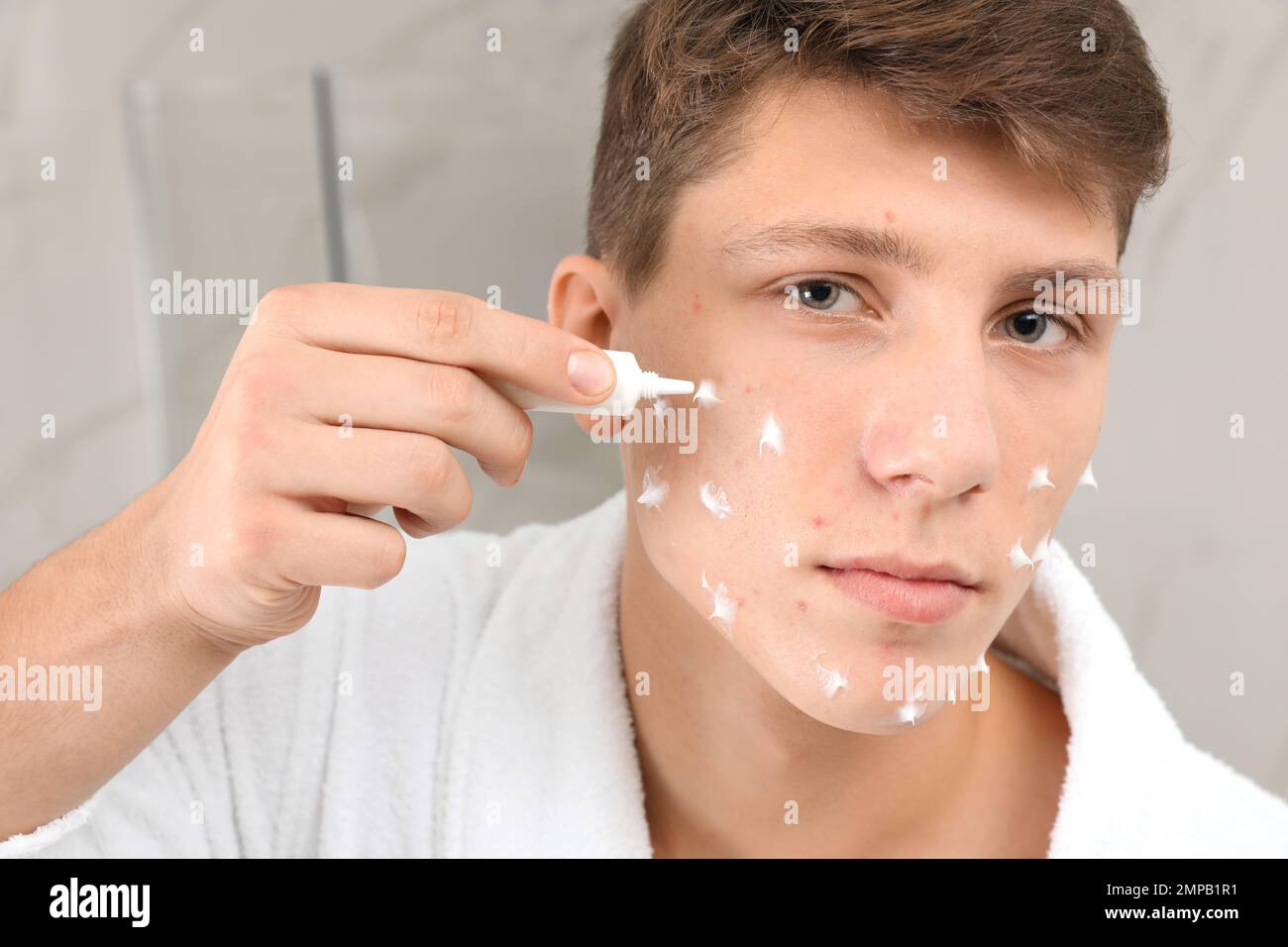 Teen guy with acne problem applying cream in bathroom Stock Photo - Alamy